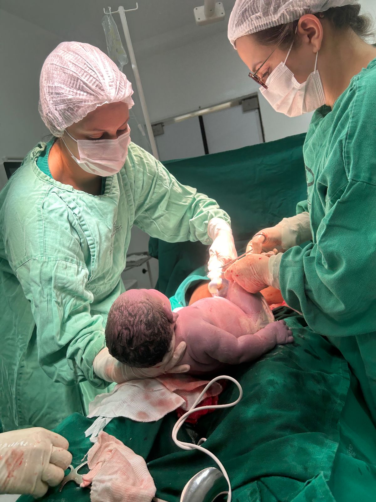 Parto histórico: maior peso registrado pelo HNSA - Diário de Ipatinga